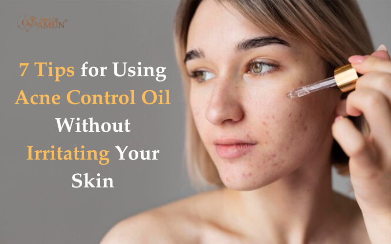 7 Tips for Using Acne Control Oil Without Irritating Your Skin