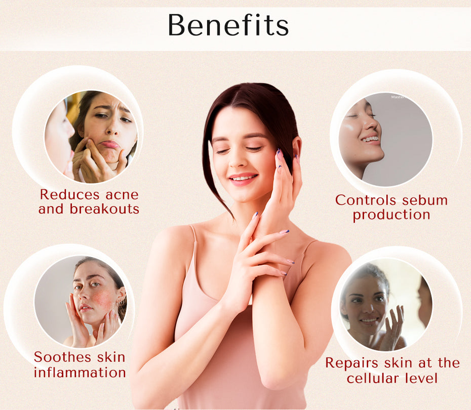 Get the Glow: Buy Oils of Amun's Acne Control Oil